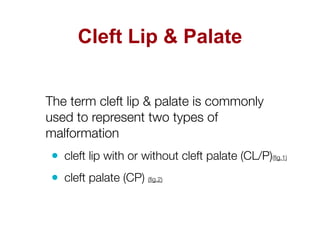 Cleft lip & Cleft palate | PDF