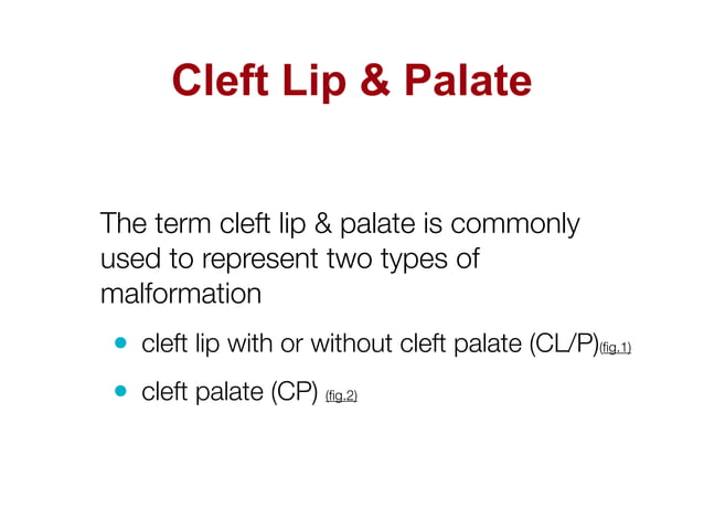 Cleft lip & Cleft palate | PDF