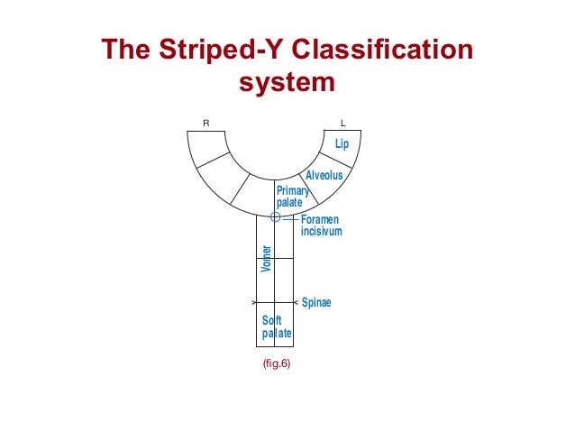 Cleft lip & Cleft palate