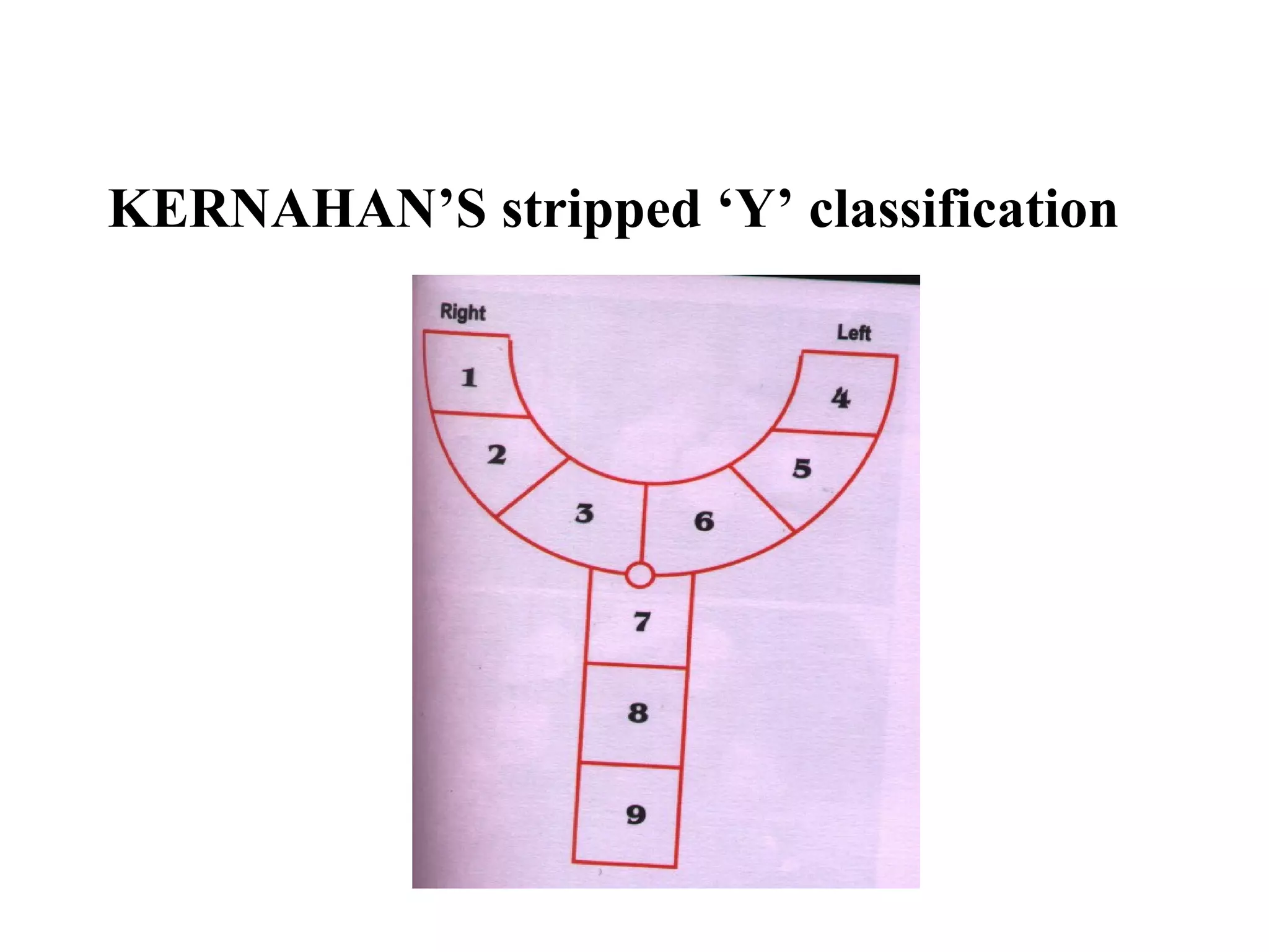 Cleft lip & palate management in orthodontics | PPT