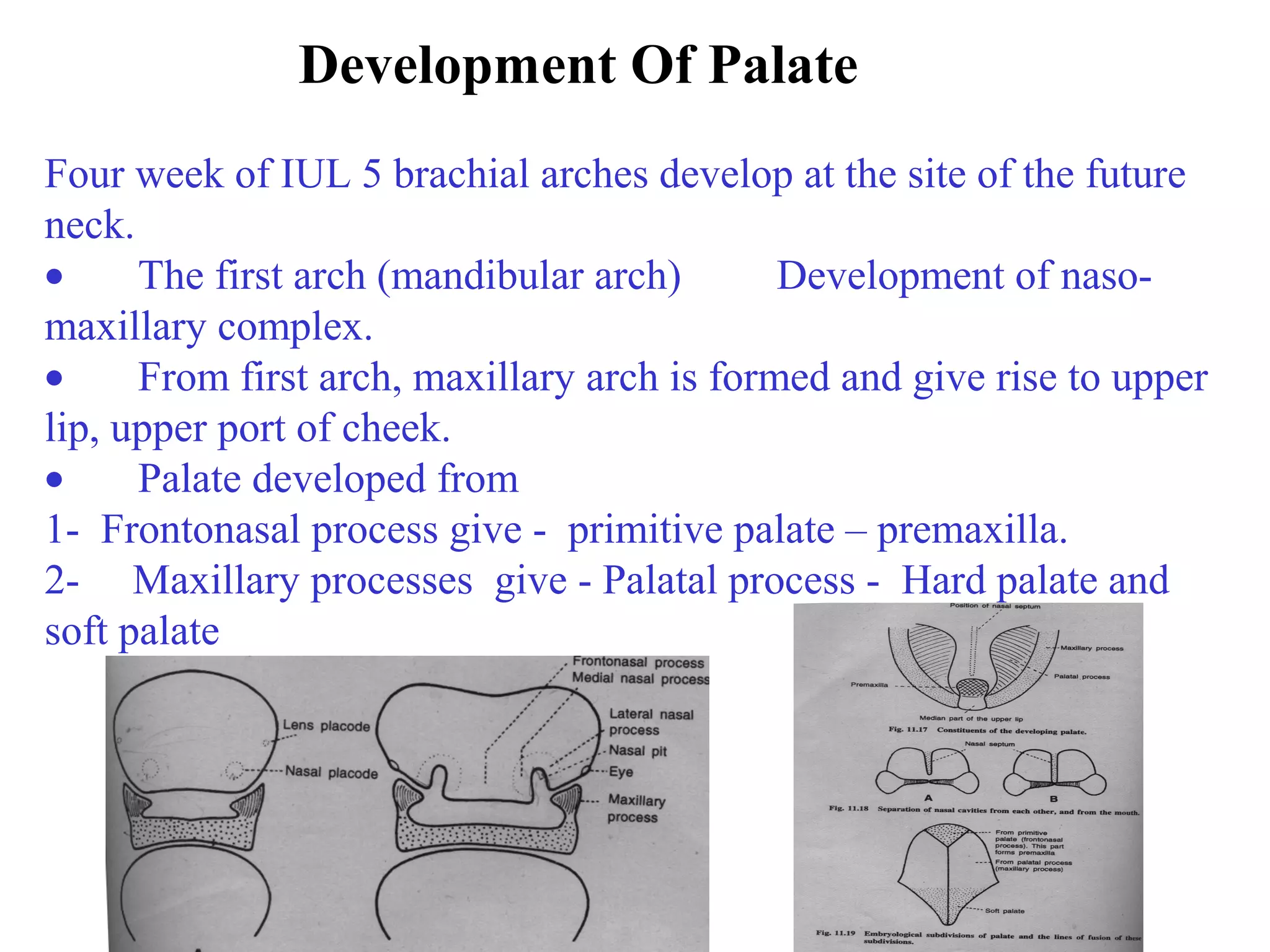 Cleft lip & palate management in orthodontics | PPT