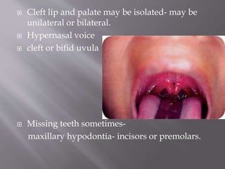 Cleft lip and palate | PPTX