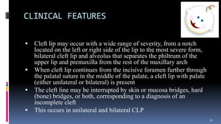 CLEFT LIP & PALATE | PPT