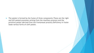 Cleft lip & palate | PPT