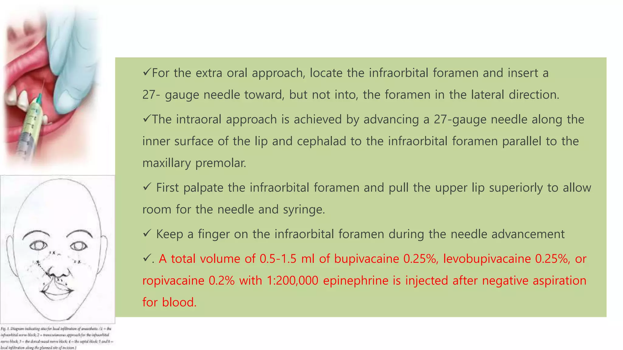 ANESTHESIA MANAGEMENT OF CLEFT LIP & PALATE | PPTX