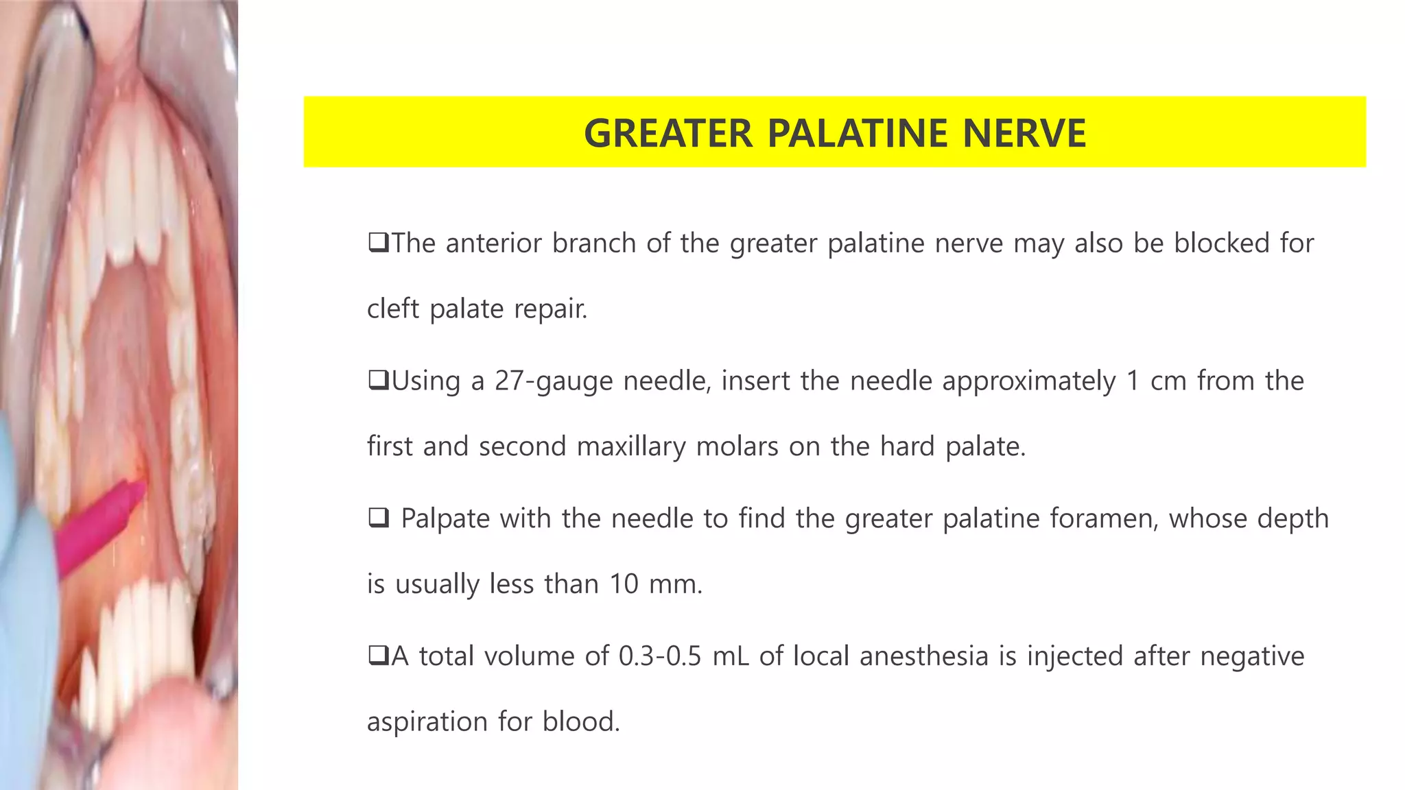 ANESTHESIA MANAGEMENT OF CLEFT LIP & PALATE | PPTX