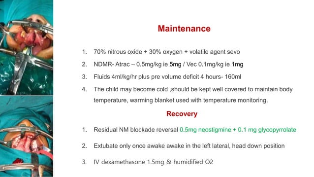 ANESTHESIA MANAGEMENT OF CLEFT LIP & PALATE | PPTX