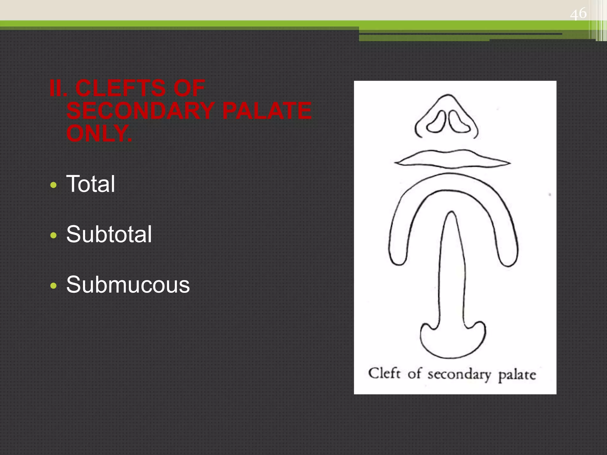 Cleft lip palate | PPT