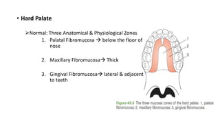 Cleft lip and palate | PPTX