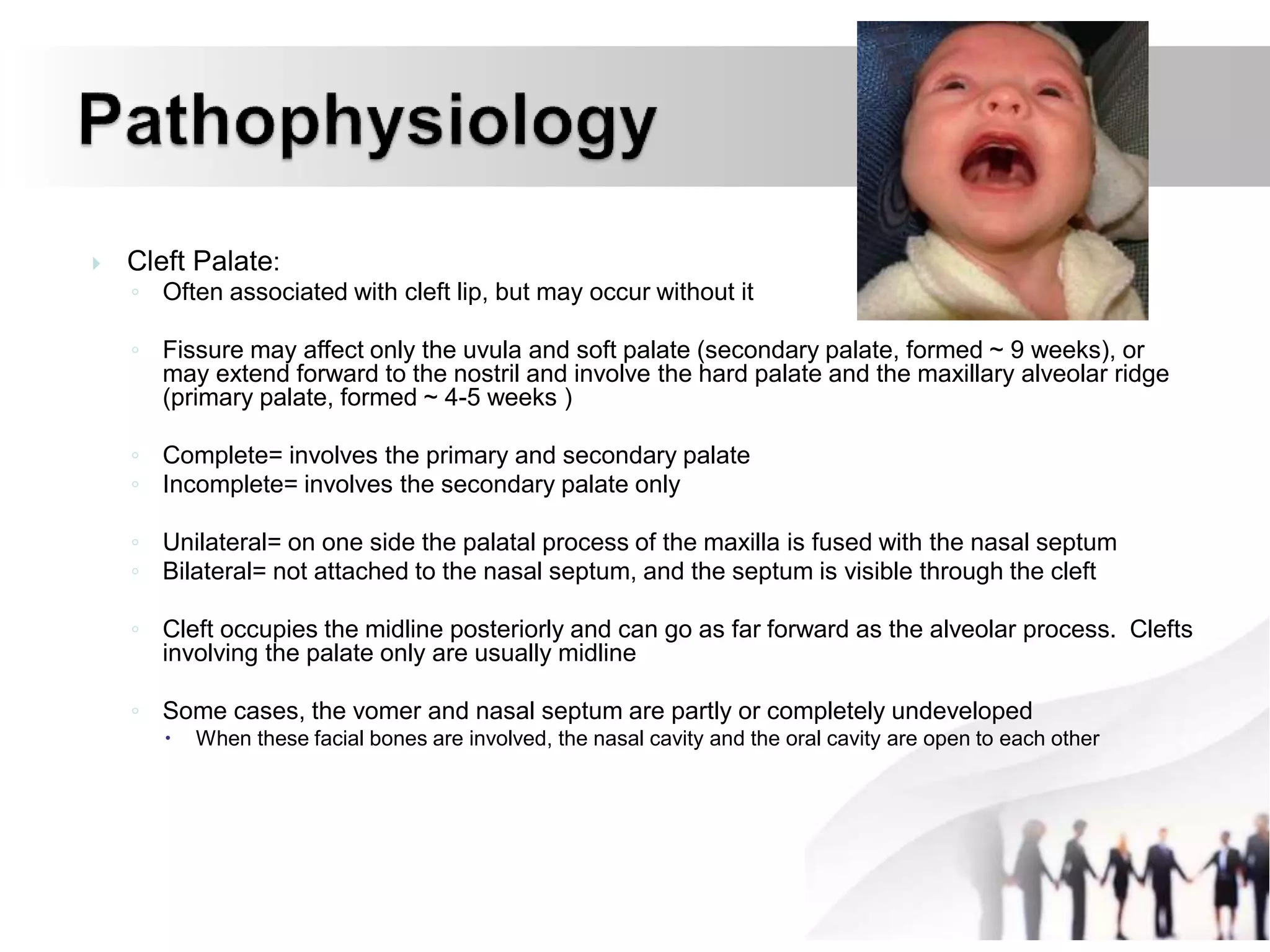 Cleft lip & palate.ppt