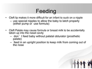Cleft lip & palate.ppt