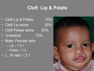 seminar on cleft lip and cleft palate.pptx