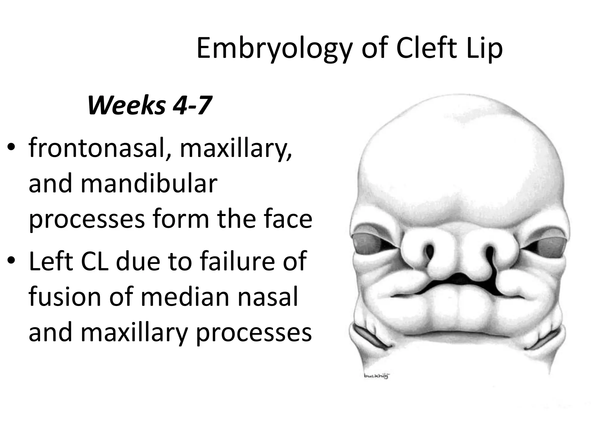 Cleft Lip & Palate KIU.pptx