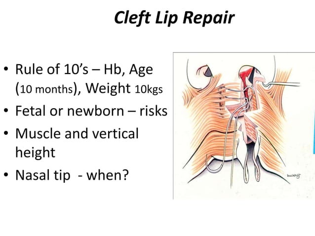 Cleft Lip & Palate KIU.pptx | Pregnancy | Reproductive Health
