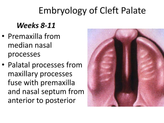 Cleft Lip & Palate KIU.pptx | Pregnancy | Reproductive Health