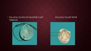 CLEFT LIP & PALATE ( SEMI 2).pptx