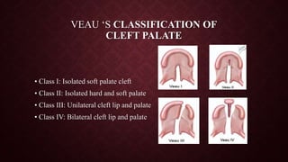 CLEFT LIP & PALATE ( SEMI 2).pptx | Ear, Nose and Throat Conditions ...