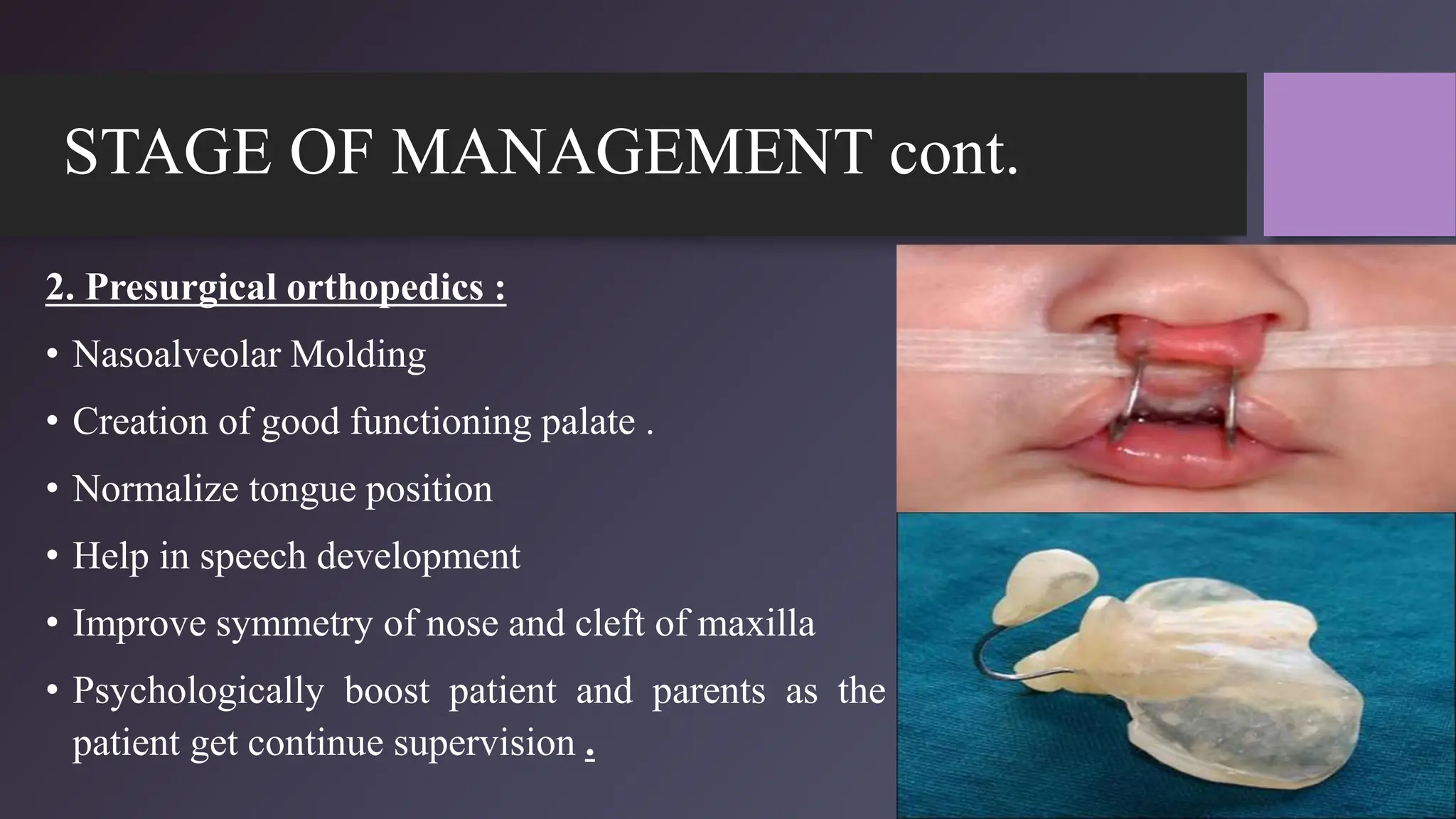 Presentation on Cleft Lip and Cleft Palate | PPTX