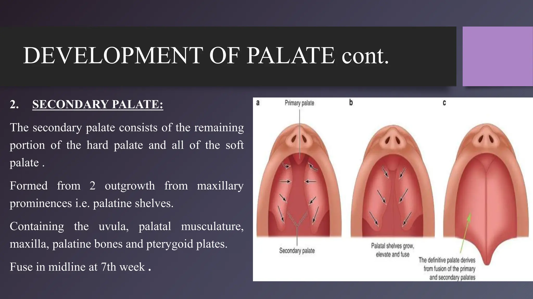Presentation on Cleft Lip and Cleft Palate | PPTX
