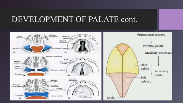 Presentation on Cleft Lip and Cleft Palate | PPTX | Pregnancy | Reproductive Health