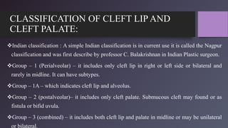 Presentation on Cleft Lip and Cleft Palate | PPTX