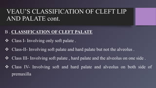 Presentation on Cleft Lip and Cleft Palate | PPTX
