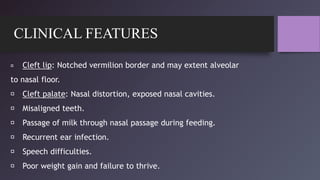 Presentation on Cleft Lip and Cleft Palate | PPTX