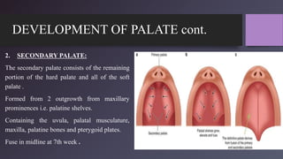 Presentation on Cleft Lip and Cleft Palate | PPTX