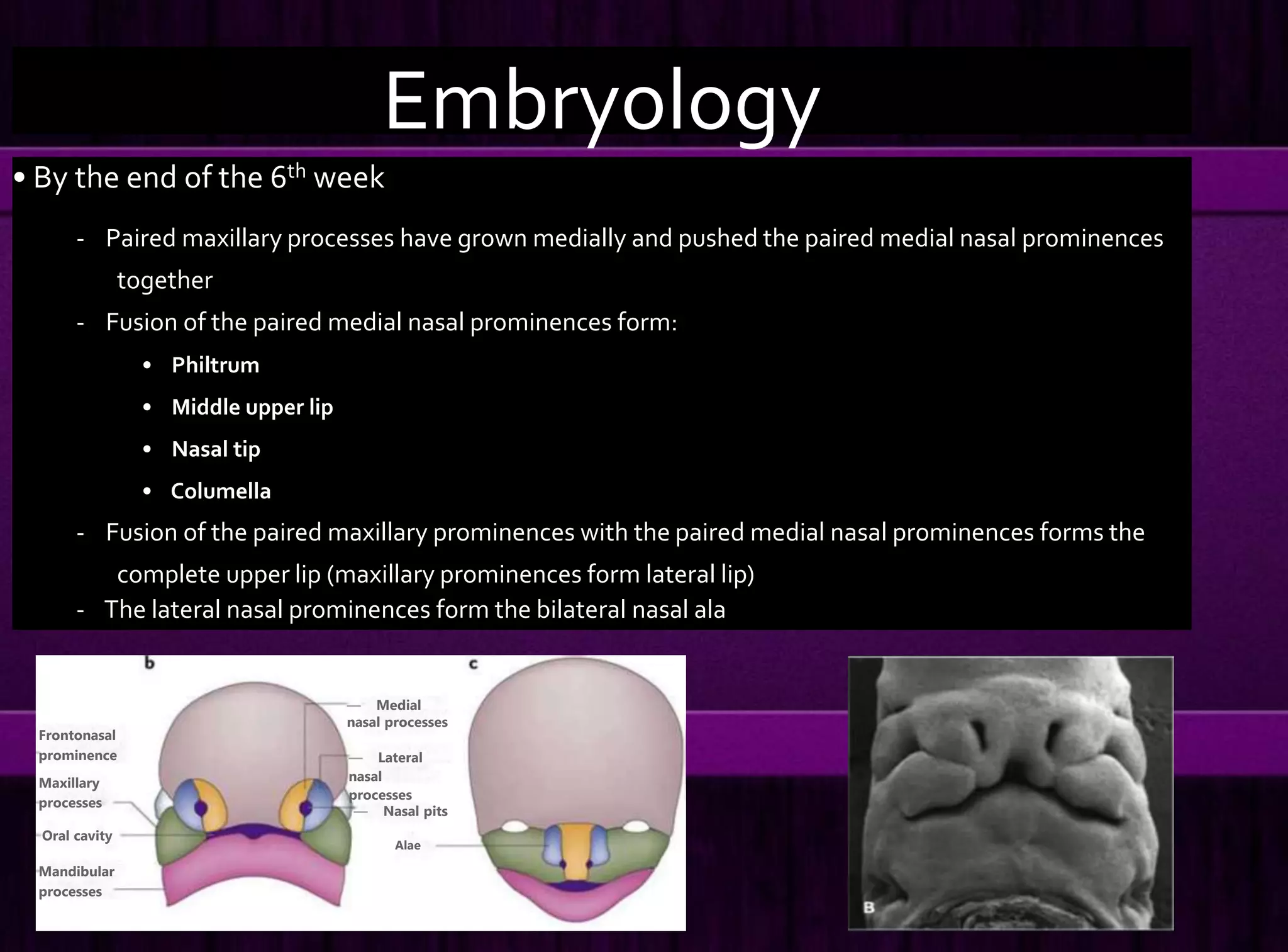 Cleft lip repair | PPTX