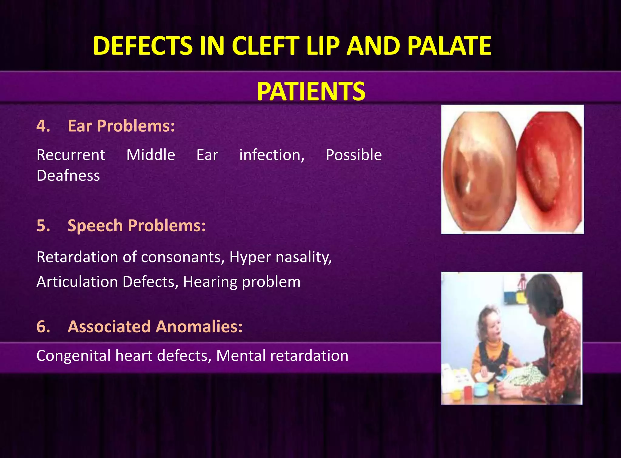 Cleft lip repair | PPTX