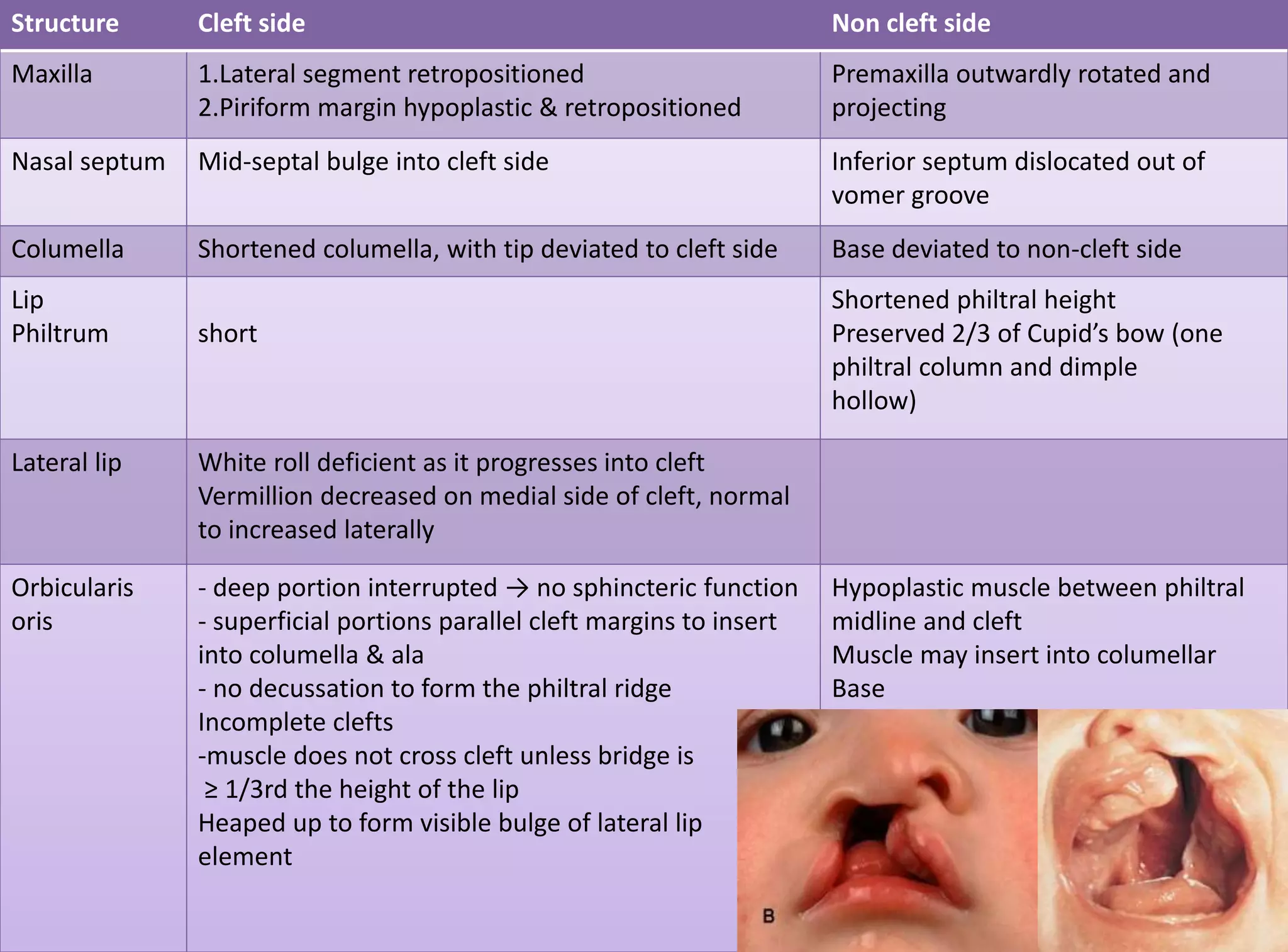 Cleft lip repair | PPTX