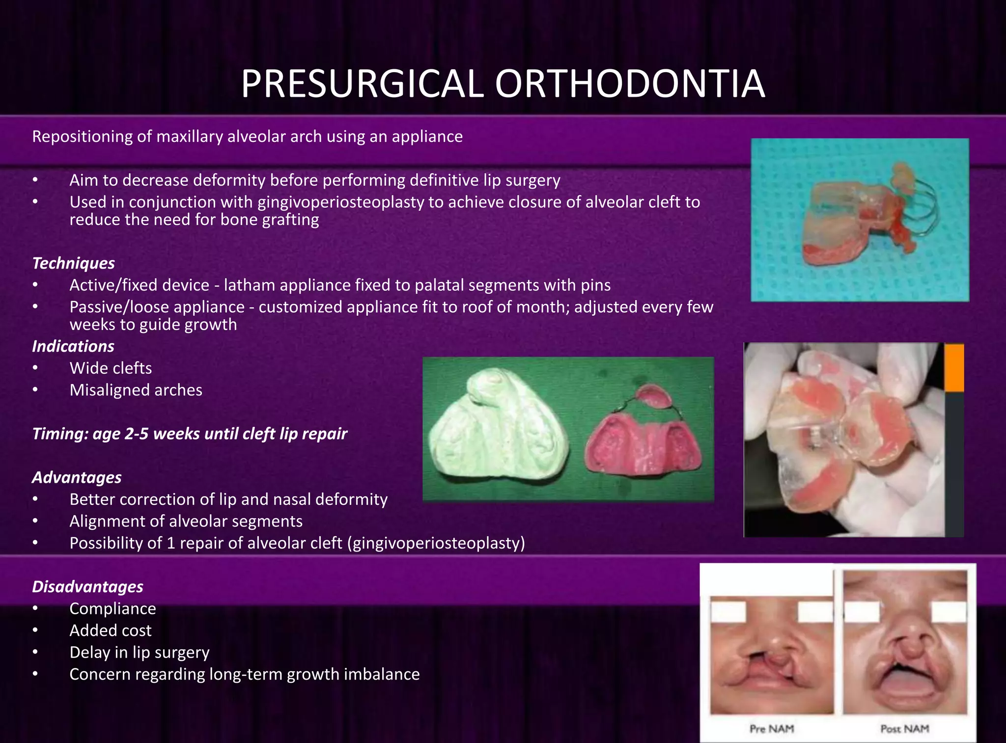 Cleft lip repair | PPTX