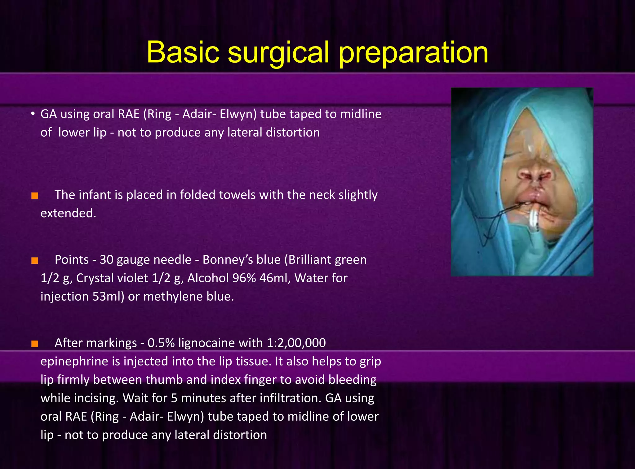 Cleft lip repair | PPTX