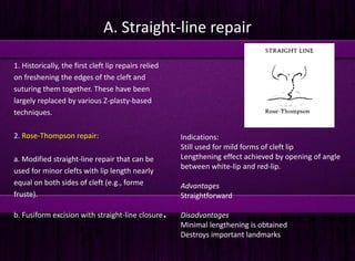Cleft lip repair | PPTX