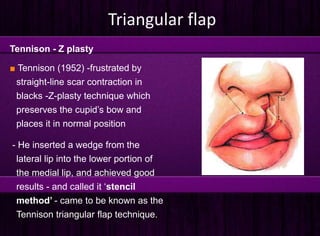 Cleft lip repair | PPTX