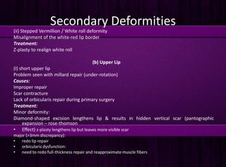 Cleft lip repair | PPTX