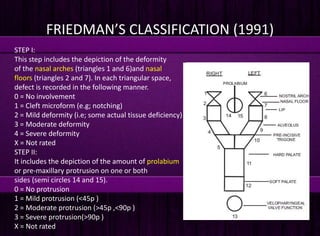 Cleft lip repair | PPT
