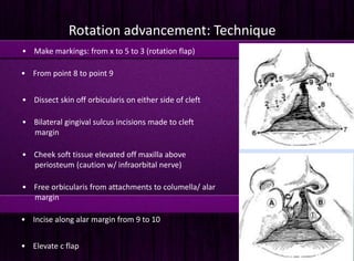 Cleft Lip Repair Techniques