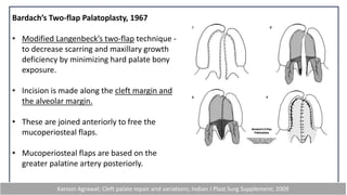 CASE PRESENTATION ON CLEFT LIP Mazhil.pptx