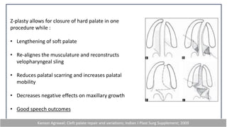 CASE PRESENTATION ON CLEFT LIP Mazhil.pptx