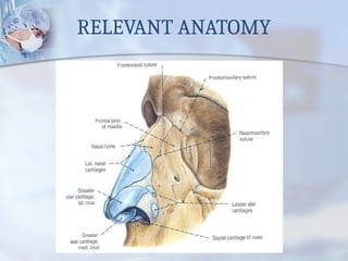 CLEFT NOSE CLEFT NOSE RHINOPLASTY v.pptx