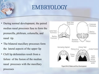 CLEFT NOSE CLEFT NOSE RHINOPLASTY v.pptx | Ear, Nose and Throat ...