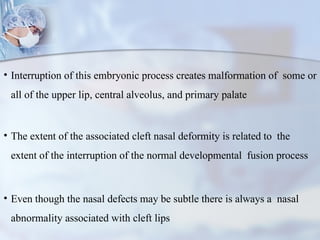 CLEFT NOSE CLEFT NOSE RHINOPLASTY v.pptx