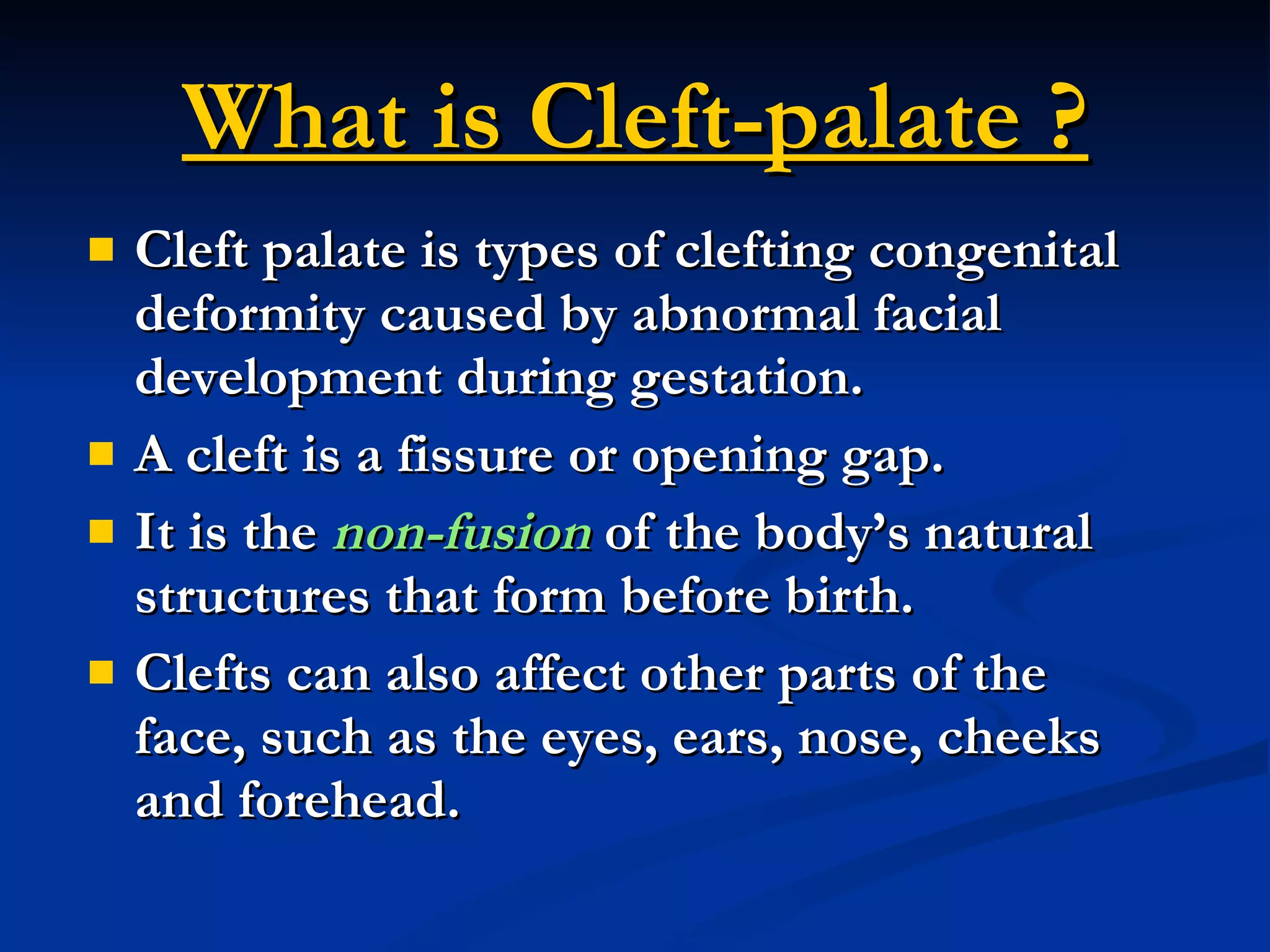 Cleft palate | PPT