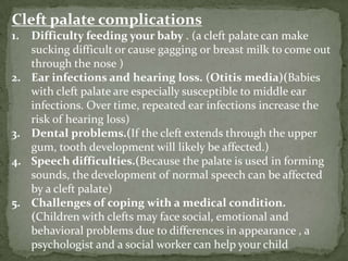 Cleft palate dental oral pathology | PPTX