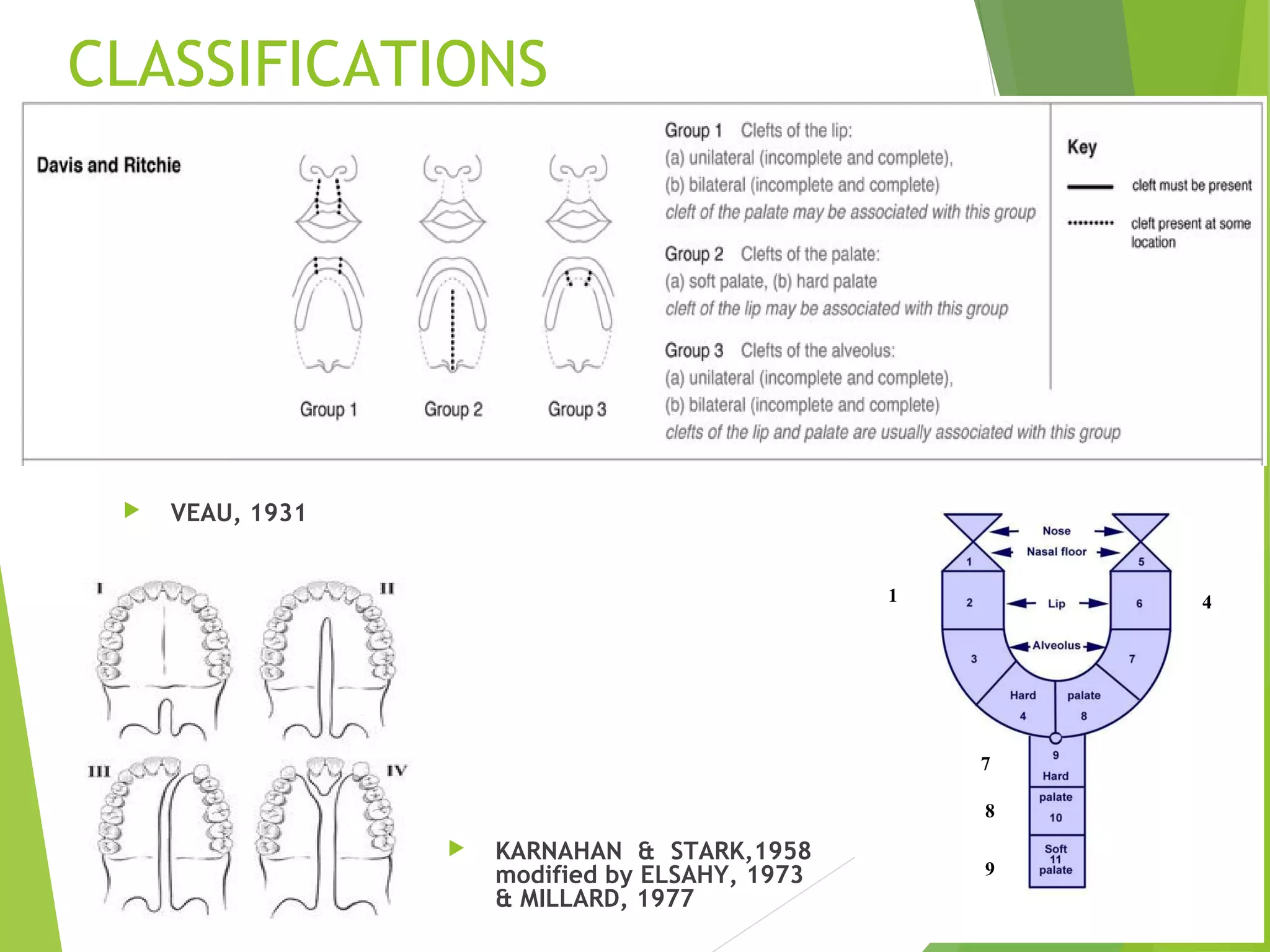 Surgical treatments in Cleft palate | PPT
