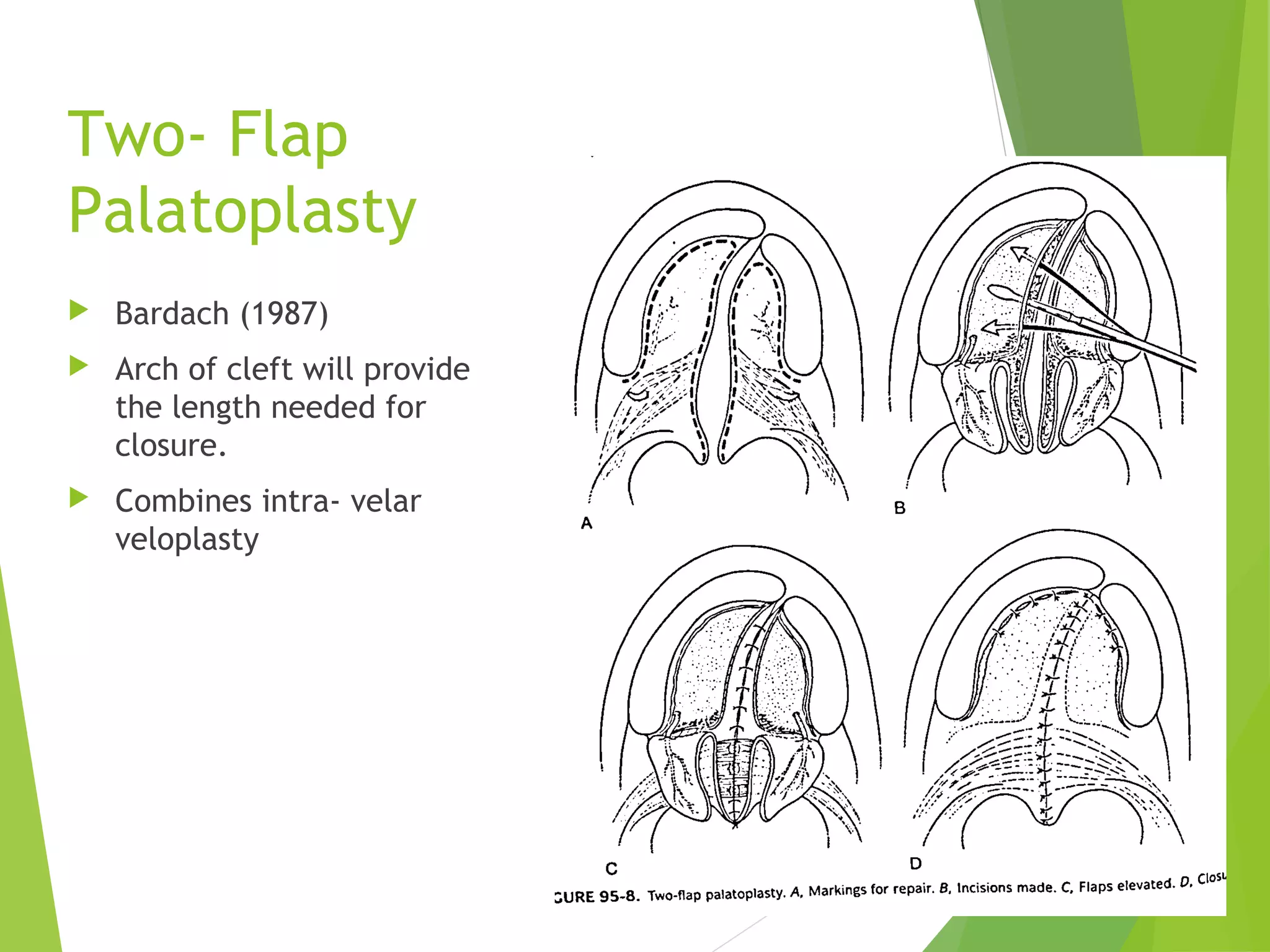 Surgical treatments in Cleft palate | PPT