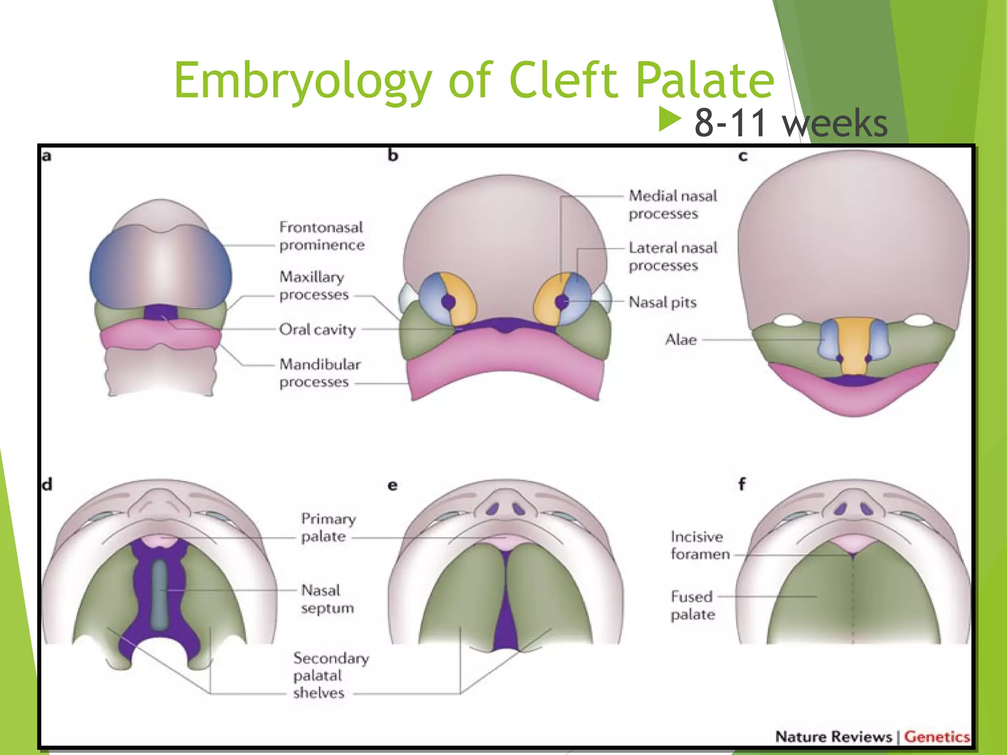 Surgical treatments in Cleft palate | PPT