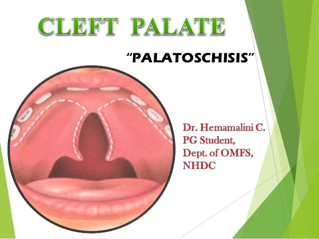 Surgical treatments in Cleft palate