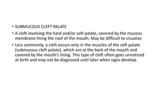Cleft palate | PPTX